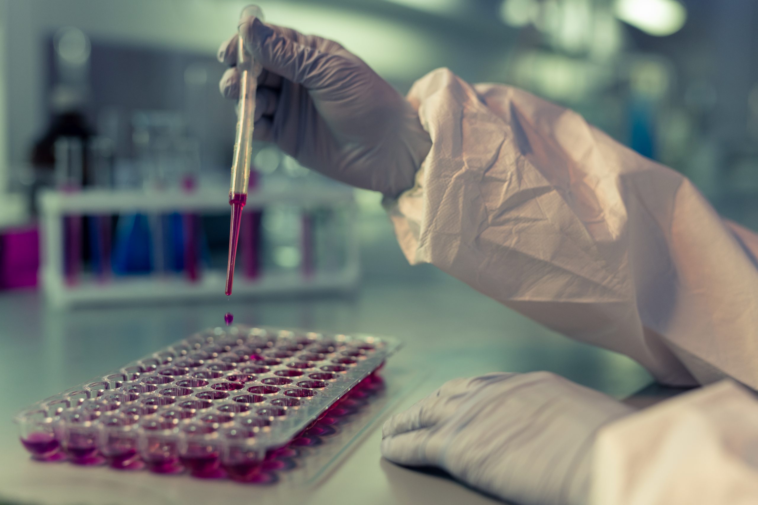 What are the differences and applications between the microplate reader ...